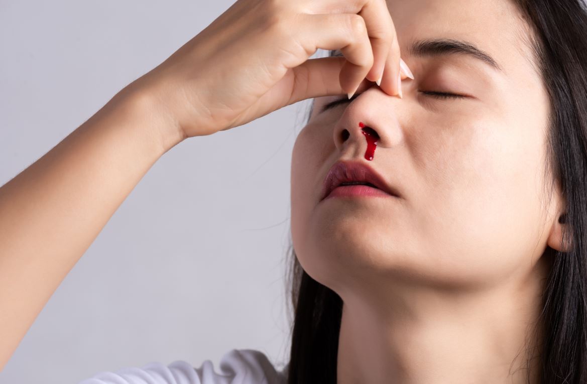 Saignements de nez : que faire quand ils sont fréquents