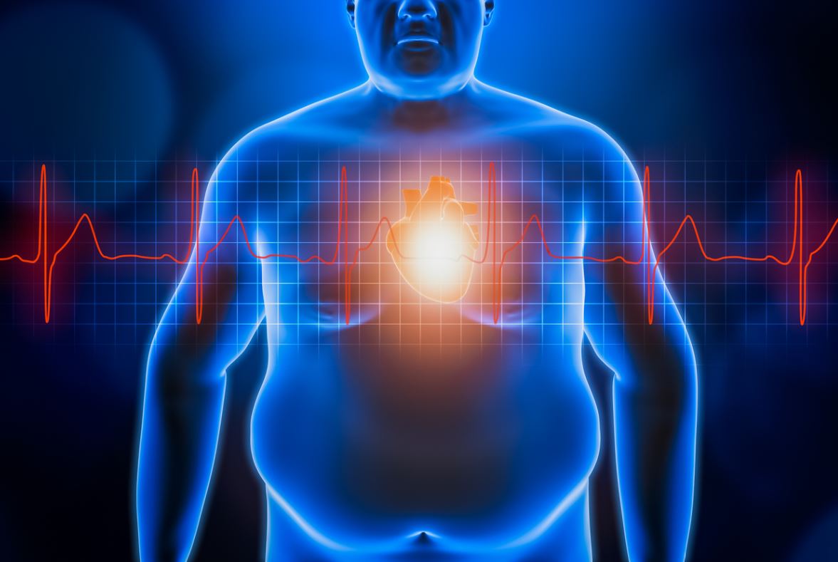 Obésité : les complications physiques et psychologiques