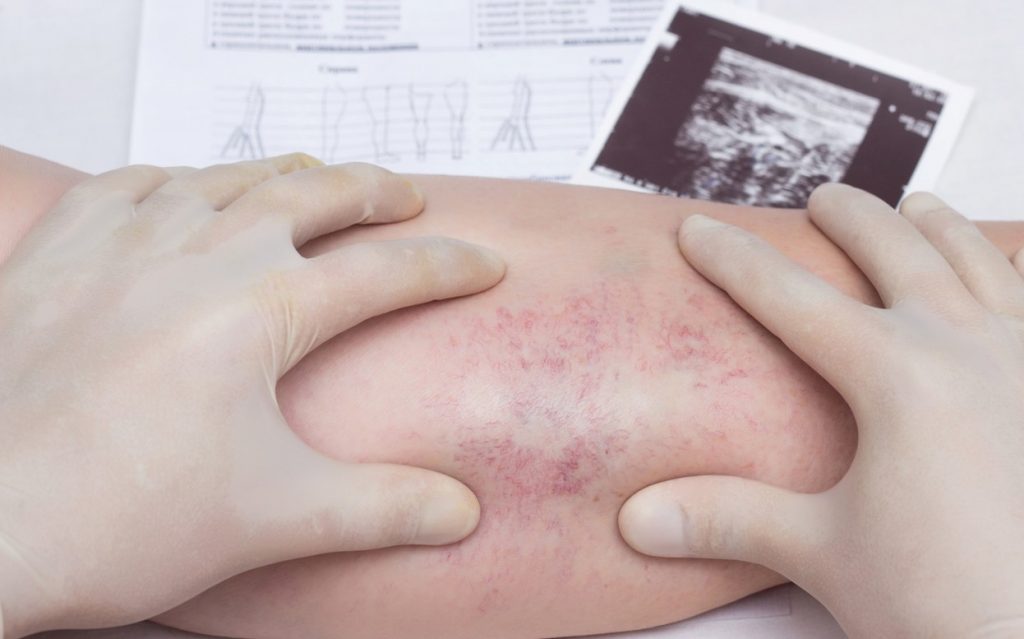 Oeil rouge ou irrité : les conseils pour choisir le bon collyre