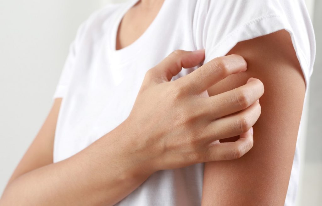 Urticaire : causes, traitements et conseils préventifs