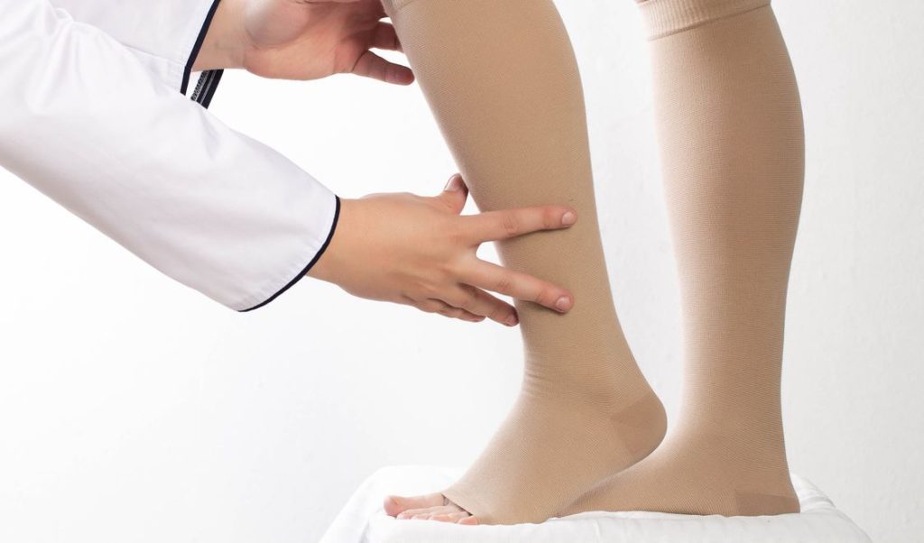 Jambes lourdes : comment traiter l'insuffisance veineuse